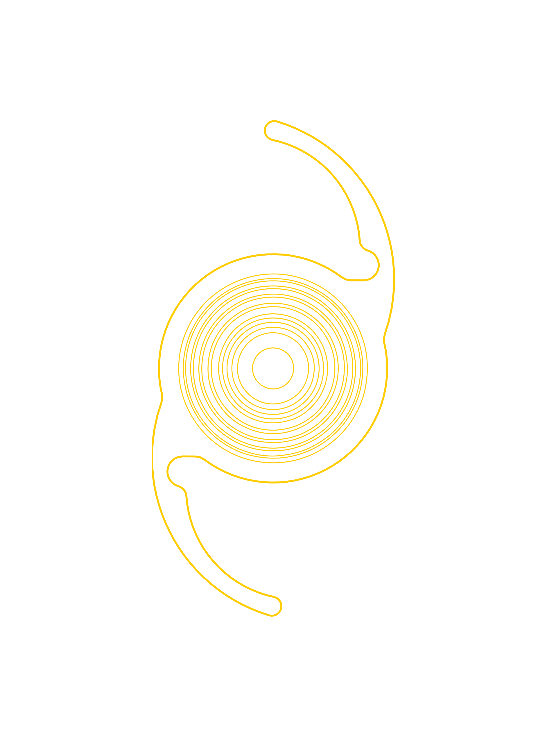 TECNIS Synergy® OptiBlue® IOL ZFR00V (PRELOADED DFR00V) – Product ...