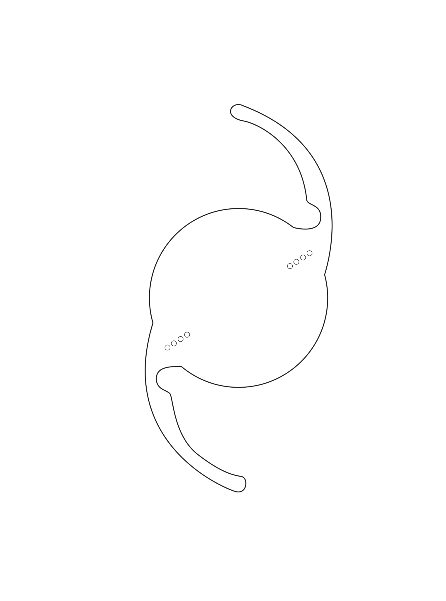 TECNIS® TORIC 1-PIECE IOL ZCT100, ZCT150, ZCT225, ZCT300, ZCT375 ...