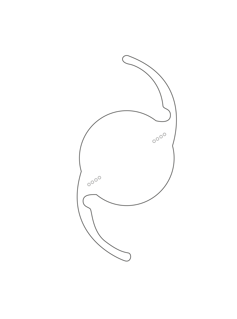 TECNIS® TORIC 1-PIECE IOL ZCT100, ZCT150, ZCT225, ZCT300, ZCT375 ...